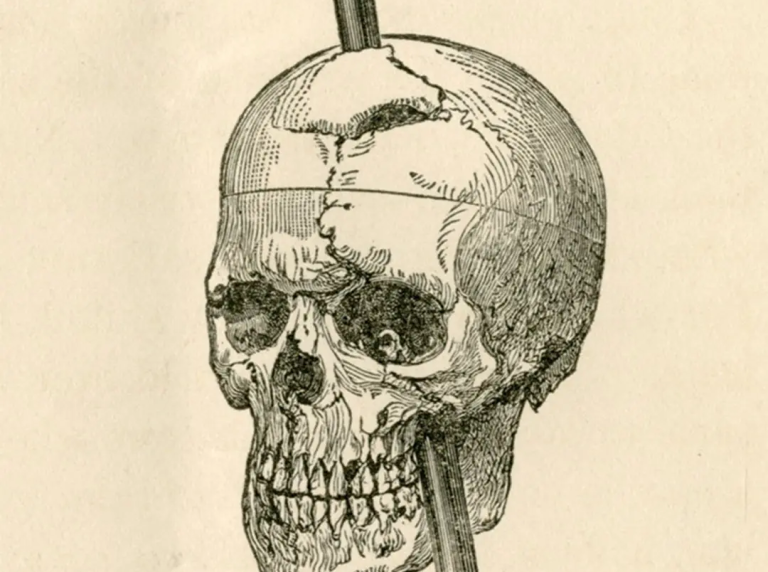 Most of what we know about a famous brain injury case is wrong ...